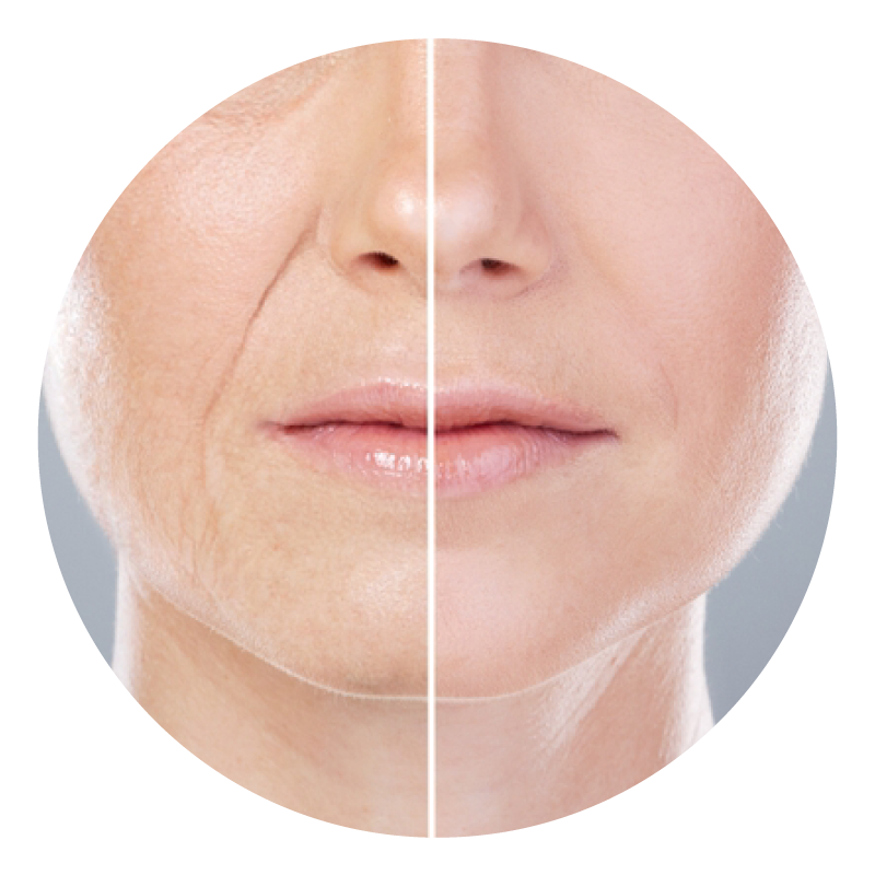 IGNITE RF - Evolução a cada modalidade